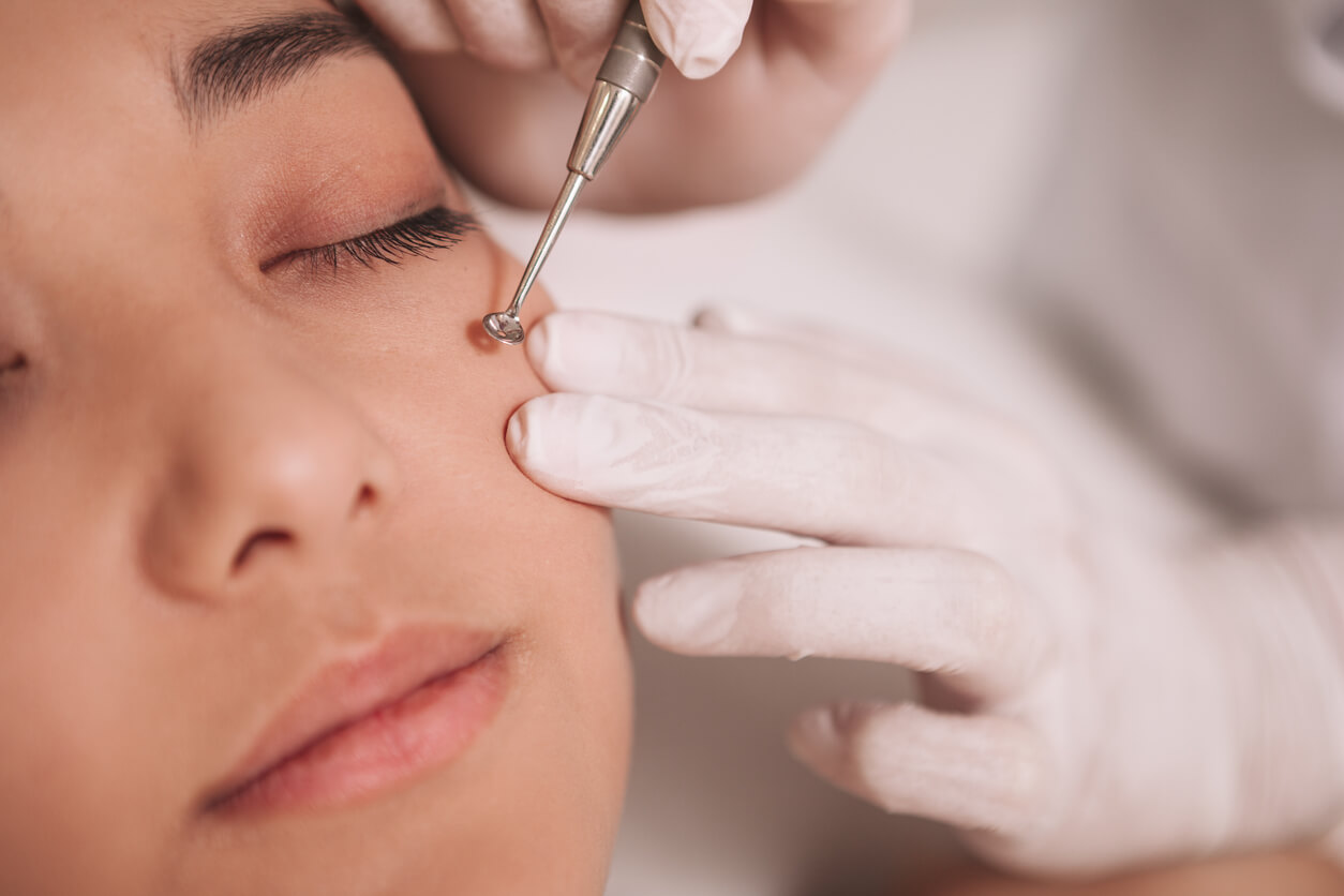 Die richtige Hautpflege gegen Mitesser | Unreine Haut | CeraVe