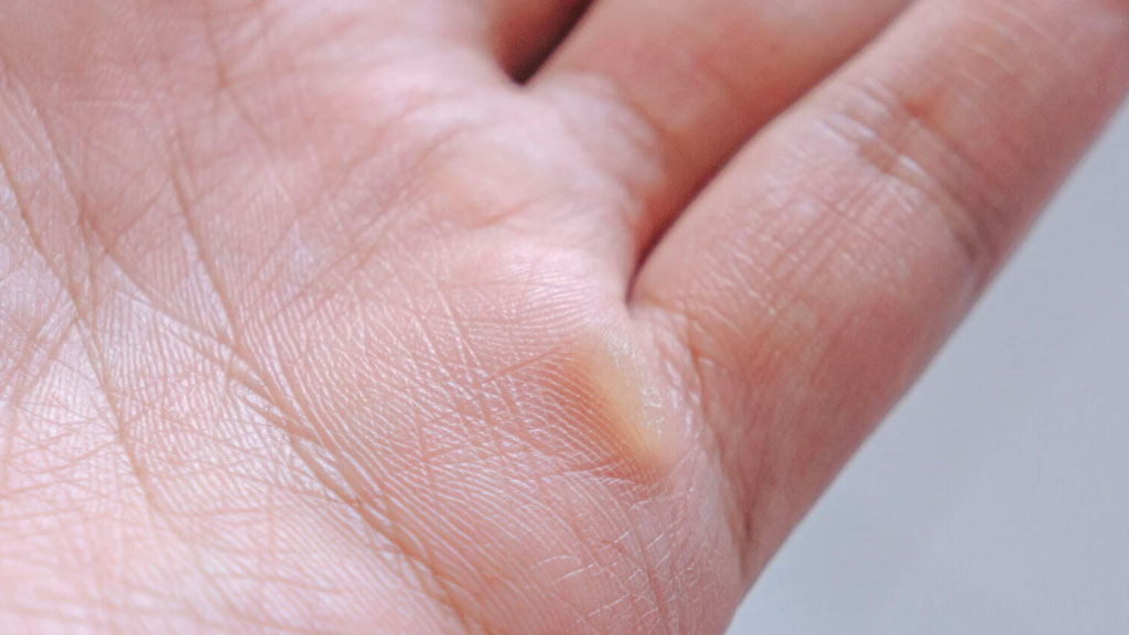 So kannst du Schwielen an den Händen entfernen ǀ CeraVe